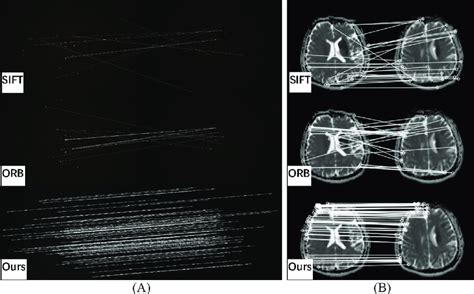 Visual Matching For Sift Orb And The Proposed Method A Pleiades Download Scientific