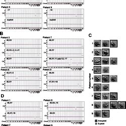 Example Results Of SNP Microarray Based Chromosome Aneuploidy Screening In Human Oocytes And