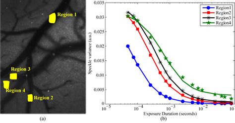 A Speckle Contrast Image 5ms Exposure Illustrating Regions Of Download Scientific Diagram