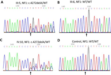 Electropherogram Sanger At Adrienne Maldonado Blog