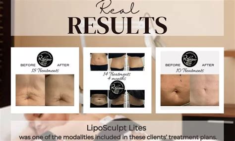 Renew Contouring From 5850 Columbus Groupon