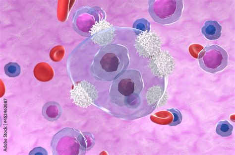 Reed Sternberg Cell In Hodgkin Lymphoma Attacked By T Cells Isometric