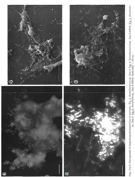 Figure 3 Microbial Aggregation And Degradation Of