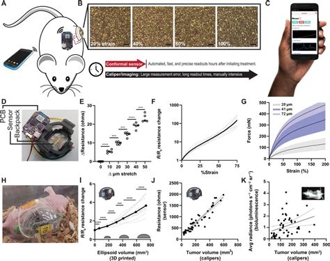 Innovative 3d Printing Enabled Strain Sensor Unlocks Real Time