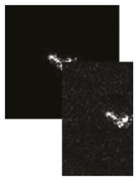 Synthetic Aperture Radar Target Recognition Based On Multimodule Image Enhancement Network