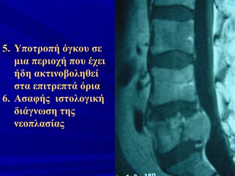 Spinal Tumors B 2010 Ppt