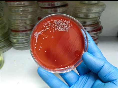 Medical Api Bacteria Bacteriology Pathogens Microbiology Sarjo