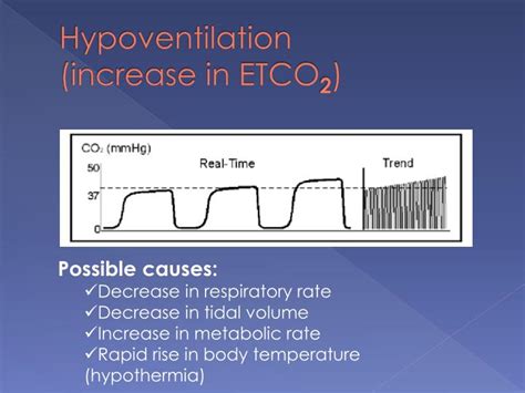 Ppt Capnography Powerpoint Presentation Id 2237765