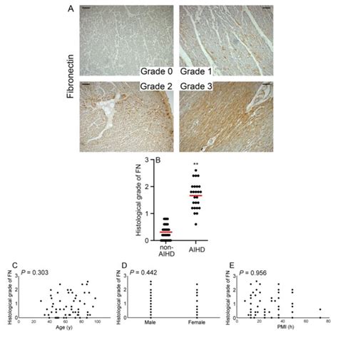 Fibronectin Fn Expression In Human Heart A Immunohistochemical