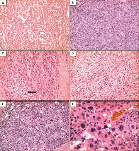 Curso De Hepatologia Caracterización Morfológica E Inmunohistoquímica
