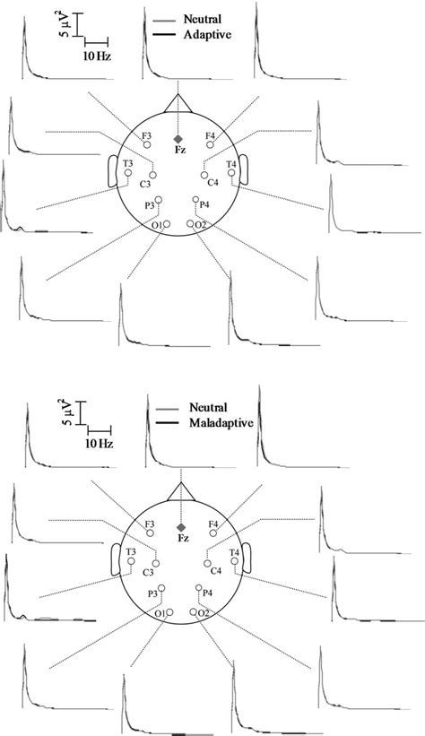 Grand Average Spectra Across The Scalp Topography For Each Condition Download Scientific Diagram