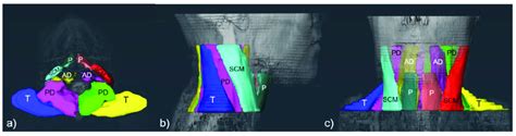 Three Dimensional Reconstruction Of Mri Muscle Volume Segmentations