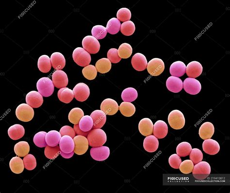 Coloured Scanning Electron Micrograph Of Staphylococcus Aureus Bacteria — Microscopy Close Up