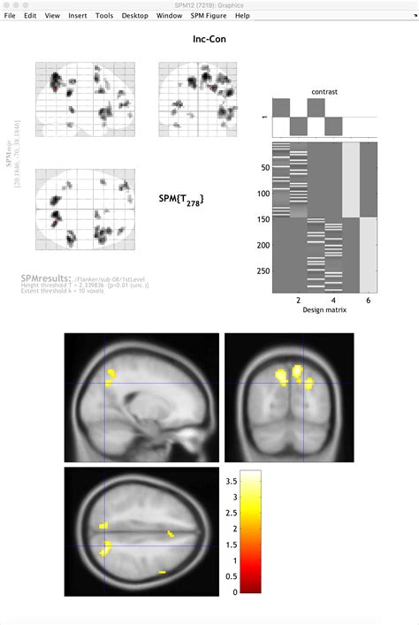 Chapter 6 Running The First Level Analysis — Andys Brain Book 10 Documentation