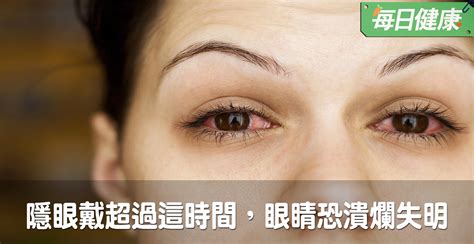 隱眼族注意！戴超過這時間，眼睛恐潰爛、失明｜每日健康 Hea