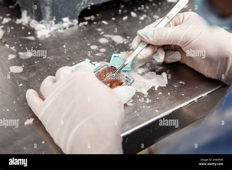 Scientist Embedding Tissues In Paraffin Blocks For Sectioning Pathology Laboratory Cancer