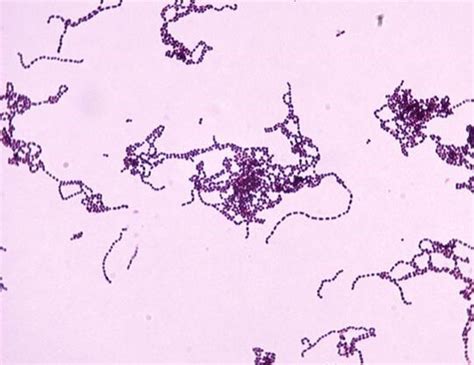 Streptococcus Pyogenes — Superbugs The Microbial World In On And Around Us Streptococcus Pyogenes — Superbugs The Microbial World In On And Around Us