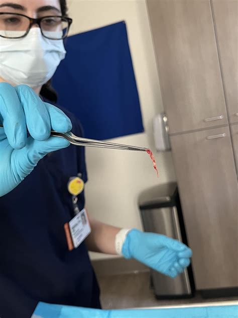 Very Thick Mucus R Sinusitis