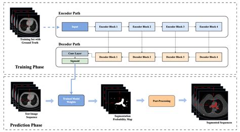 Dru Net Pulmonary Artery Segmentation Via Dense Residual U Network