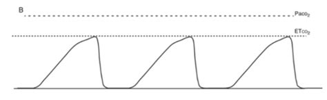 Monitoring Flashcards Quizlet