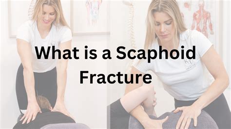 Scaphoid Fracture Kt Health And Wellness Offers Osteopathy Reformer Pilates Infrared Sauna