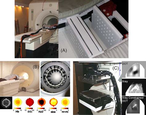 Assessing The Future Of Diffuse Optical Imaging Technologies For Breast
