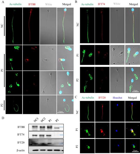 The Localization And Levels Of Ift B Related Proteins Ift88 Ift74