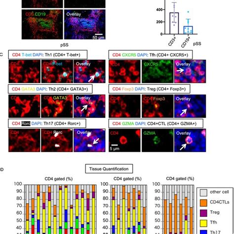 The Most Prominent Cd4 T Cell Subsets In Ss Tissues Are Th1 Cells