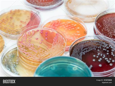 Bacterial Colonies Image And Photo Free Trial Bigstock