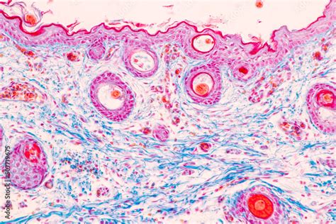 Scalp And Hair Follicles Of Human Under The Microscope In Lab Stock Photo Adobe Stock