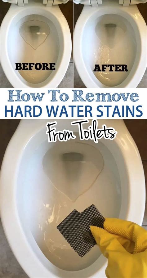 How To Get Rid Of Toilet Bowl Stains Overnight