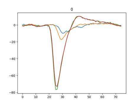 Sortinganalyzer — Spikeinterface Documentation