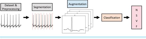 Figure 3 From Classification Of Imbalanced Ecgs Through Segmentation