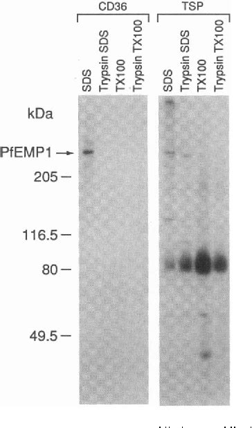 Figure 2 From Plasmodium Falciparum Erythrocyte Membrane Protein 1 Is A Parasitized Erythrocyte