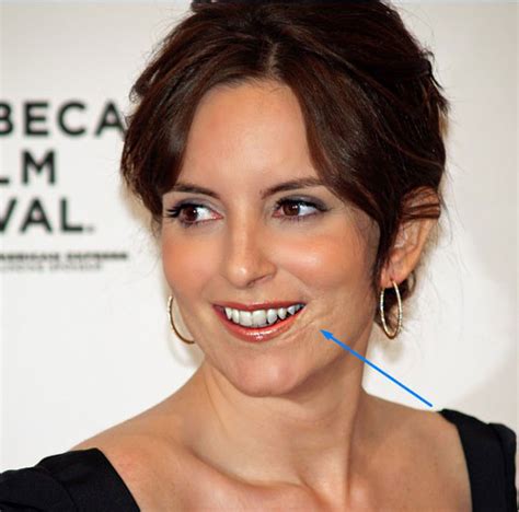 Tina Fey Plastic Surgery Before And After Tina Fey Face Scar