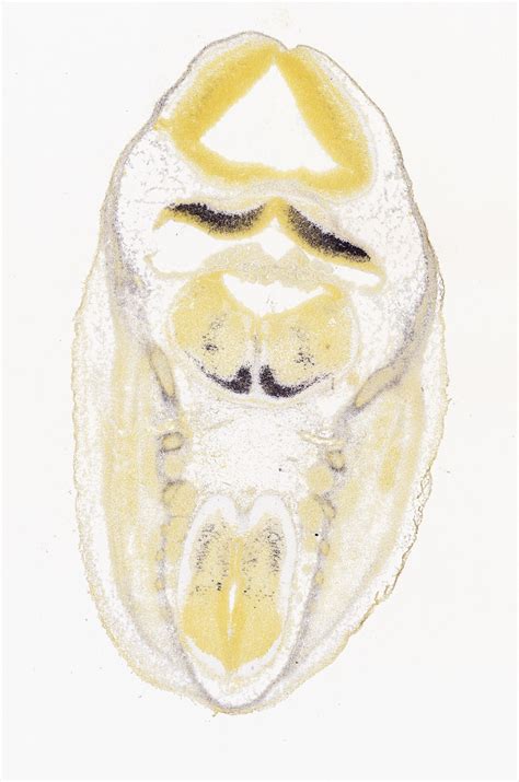 Evolution Of The Human Brain