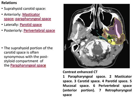 Anatomy Of Deep Neck Spaces Radiology Pictorial Representation Pptx