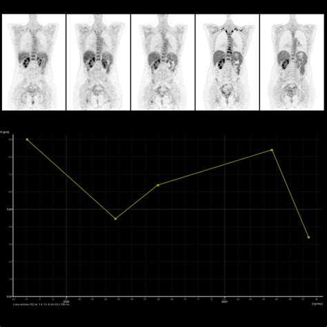 Mediso Interview™ Fusion Processing Software