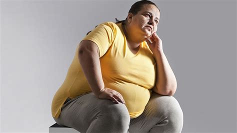 La Obesidad Es Una Enfermedad Que Pone En Peligro La Vida