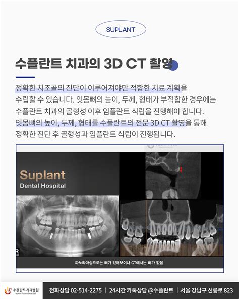 상악동 거상술과 치조제증대술로 잇몸의 형태를 원형에 가깝게 회복 압구정 수플란트 치과 서울특별시 강남구 신사동 비즈프로필