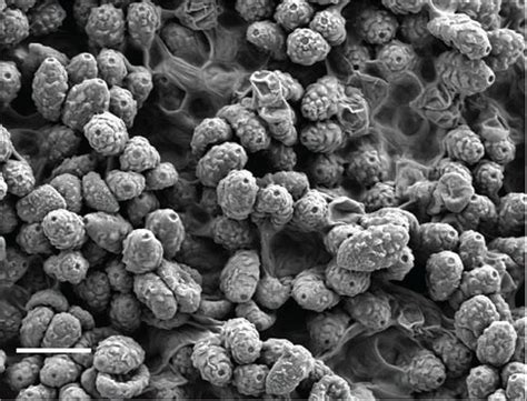 Sponorma Squarepantsii The Spongebob Mushroom Annas Blog