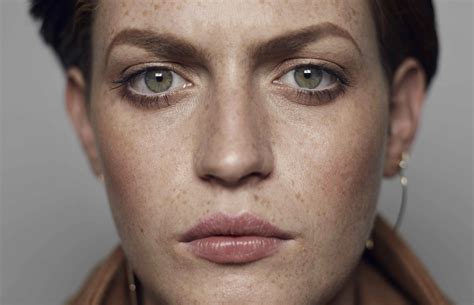 Disease Overview What Is Type 1 Gaucher Know Gaucher Disease