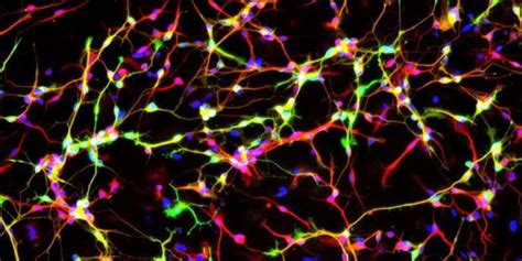Parkinsons Disease Research Puts Designer Dopamine Neurons Within Reach