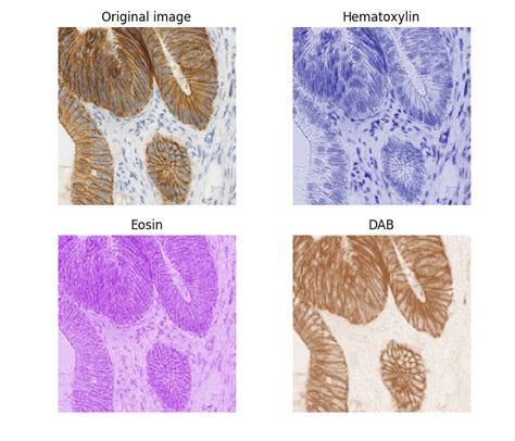 Neurohackademy Image Processing With Scikit Image