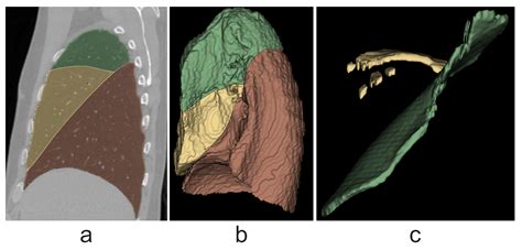 Pulmonary Fissure Segmentation In Ct Images Using Image Filtering And