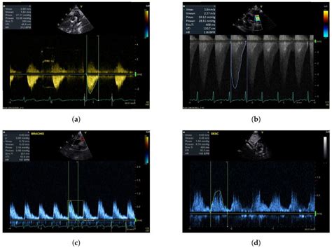 Mathematical And Computational Applications On Linkedin Machinelearning Cfd