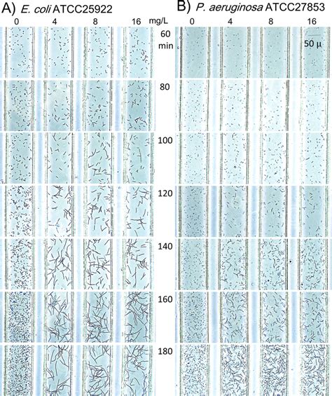 Time Lapse Analysis Of A Escherichia Coli Atcc25922 And B Pseudomonas