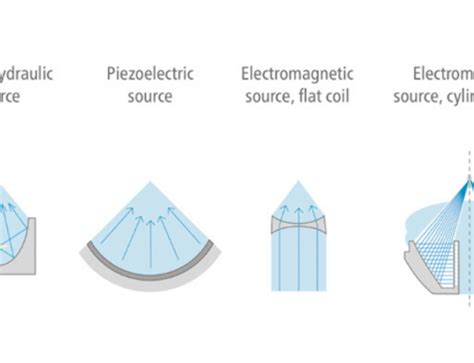 Shockwave Therapy A Safe And Effective Treatment Option For Your Patients Chronic Conditions
