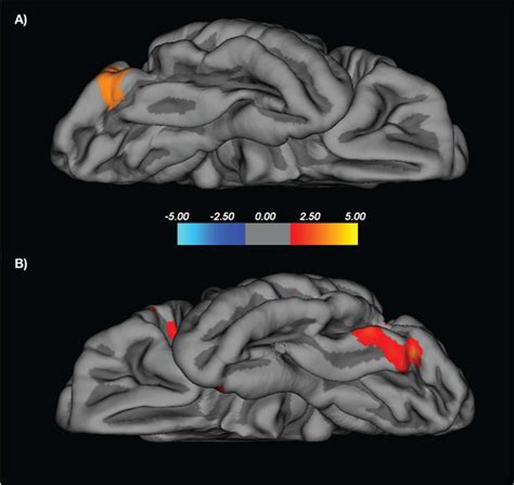 Surface Based Cortical Thickness Enlargements While Viewing Pictures
