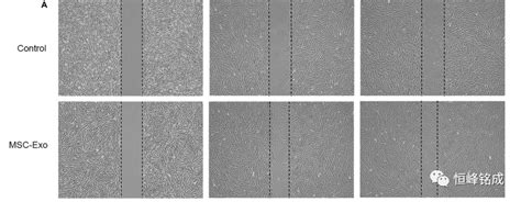 解放军总医院最新研究公布——脐带间充质干细胞衍生的外泌体治疗皮肤神经损伤，促进伤口愈合 北京恒峰铭成生物科技有限公司